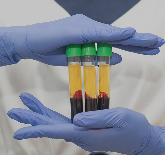 PRP Aesthetics – Samsara